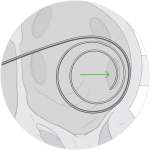 ProTrack™ Pigtail Wire - Corpmedical