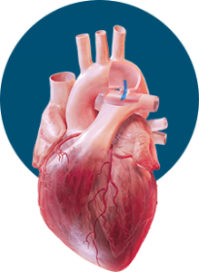Abbott - AMPLATZER™ PDA - Corpmedical