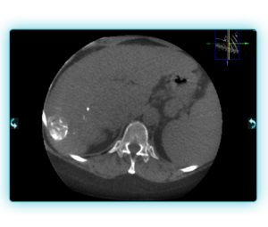 DC BeadLUMI™ - Corpmedical