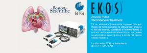 EKOS™ - Boston Scientific - Corpmedical